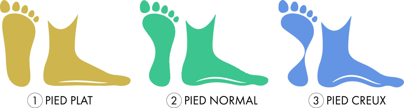 Comparatif : La semelle voute plantaire | Dubonpied.fr